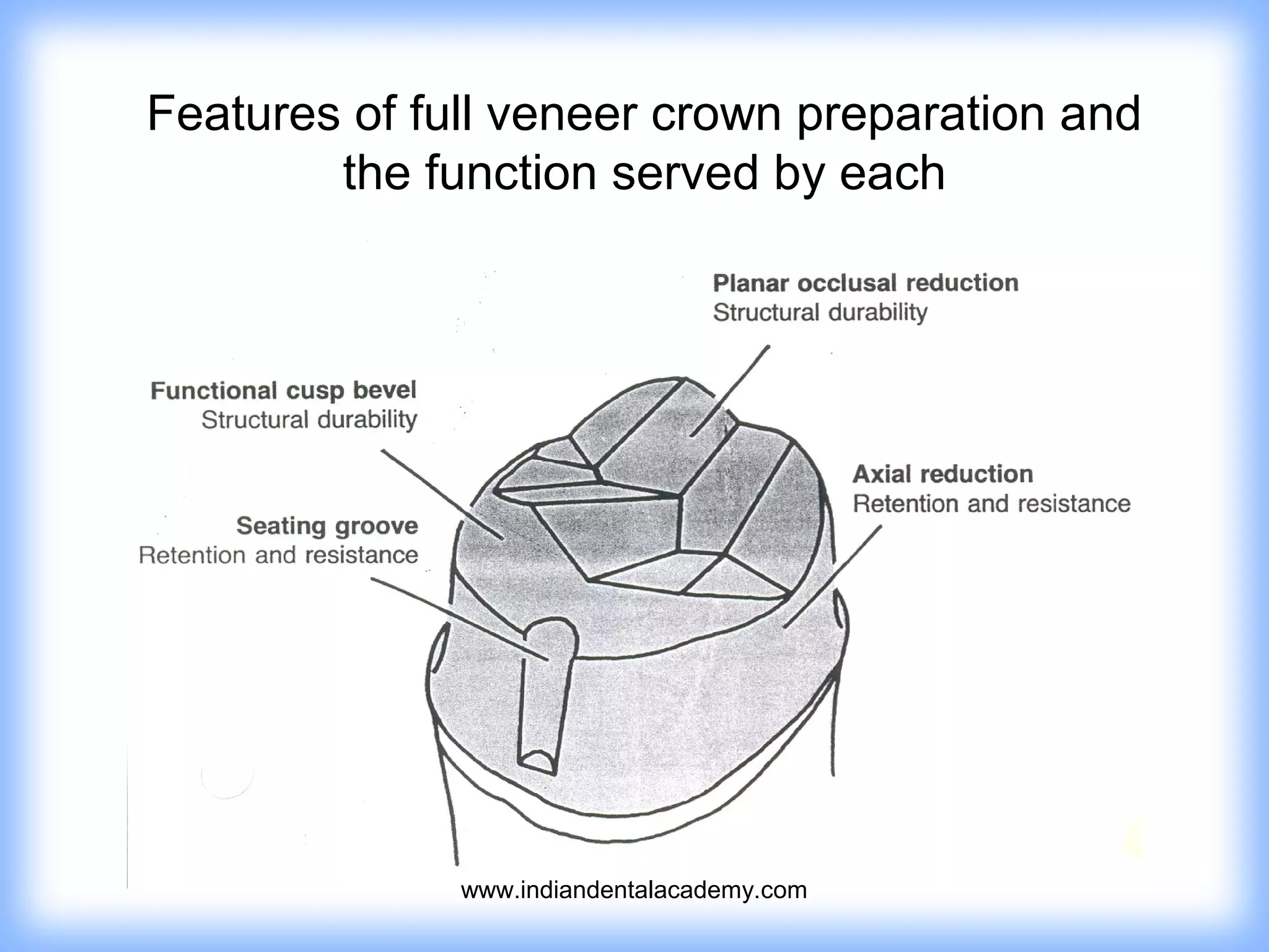 Tooth preparation for full veneer crowns /certified fixed orthodontic ...