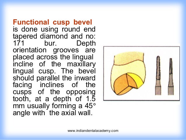 Tooth preparation for full veneer crowns /certified fixed orthodonti…
