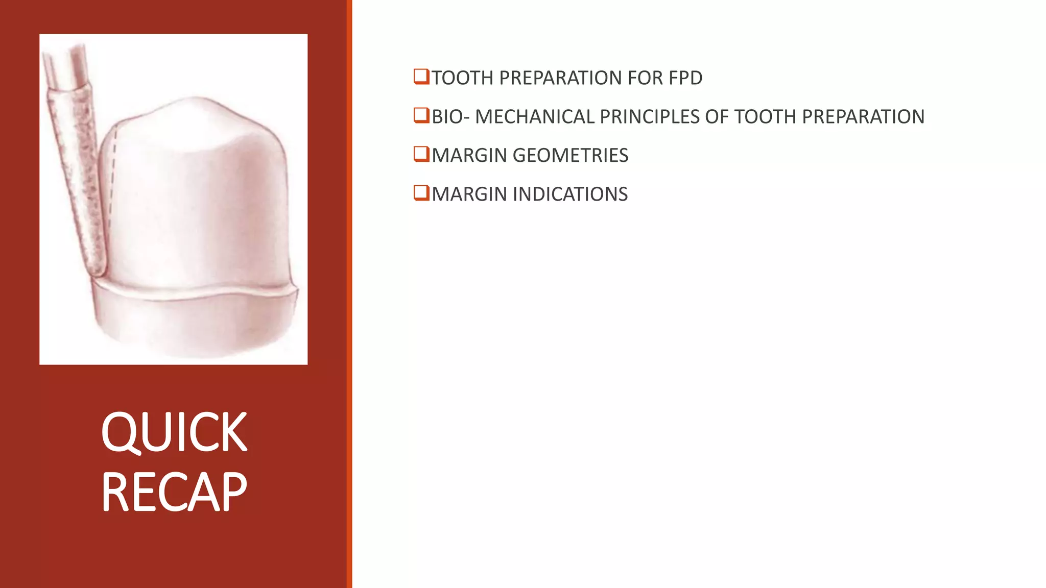 TOOTH PREPARATION: FULL VENEER CAST METAL CROWN | PPTX
