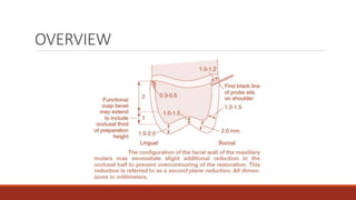 TOOTH PREPARATION: FULL VENEER CAST METAL CROWN | PPTX