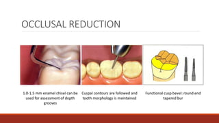 TOOTH PREPARATION: FULL VENEER CAST METAL CROWN | PPTX
