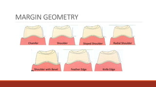 Full Metal Crown Preparation