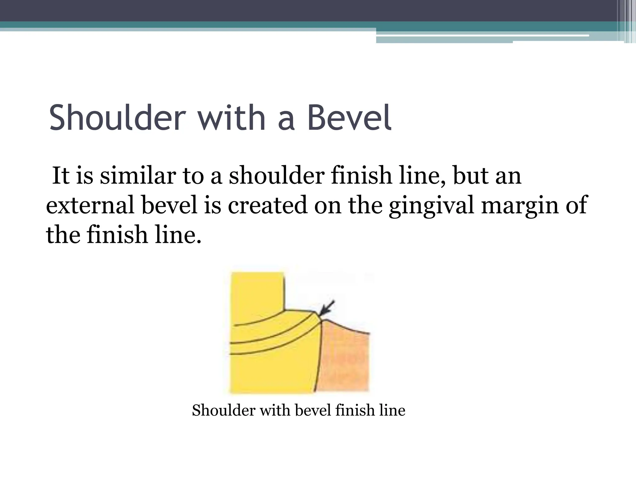 Tooth Preparation in FIXED PARTIAL DENTURE | PPTX