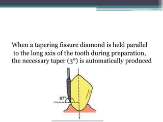 Tooth Preparation in FIXED PARTIAL DENTURE | PPTX