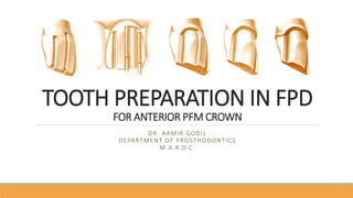 TOOTH PREPARATION: FULL VENEER ANTERIOR PFM | PPTX