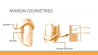 TOOTH PREPARATION: FULL VENEER ANTERIOR PFM | PPTX