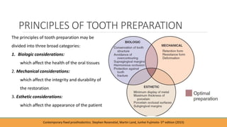 TOOTH PREPARATION: FULL VENEER ANTERIOR PFM | PPTX