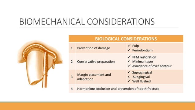 TOOTH PREPARATION: FULL VENEER ANTERIOR PFM | PPTX