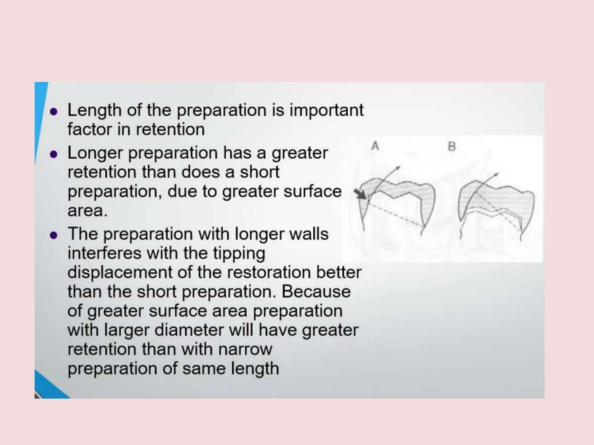 PRINCIPLES OF TOOTH PREPARATION ppt given | PPTX