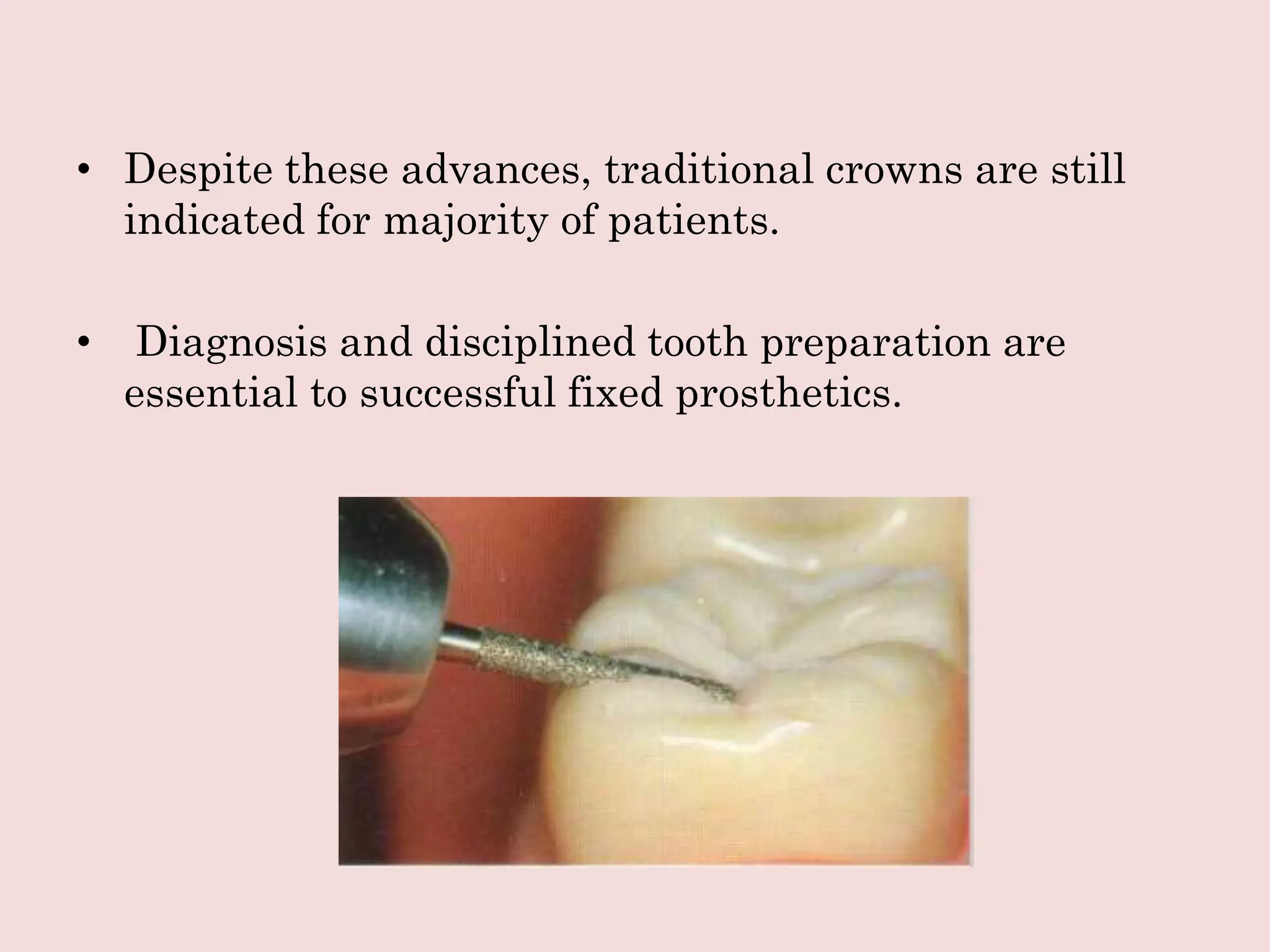PRINCIPLES OF TOOTH PREPARATION ppt given | PPTX