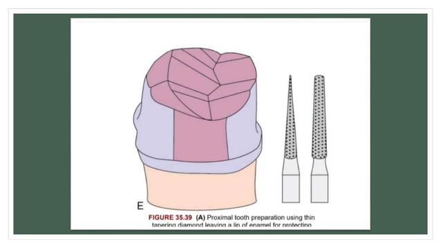 TOOTH Preparation for posterior tooth.pptx
