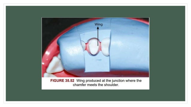 TOOTH Preparation for posterior tooth.pptx
