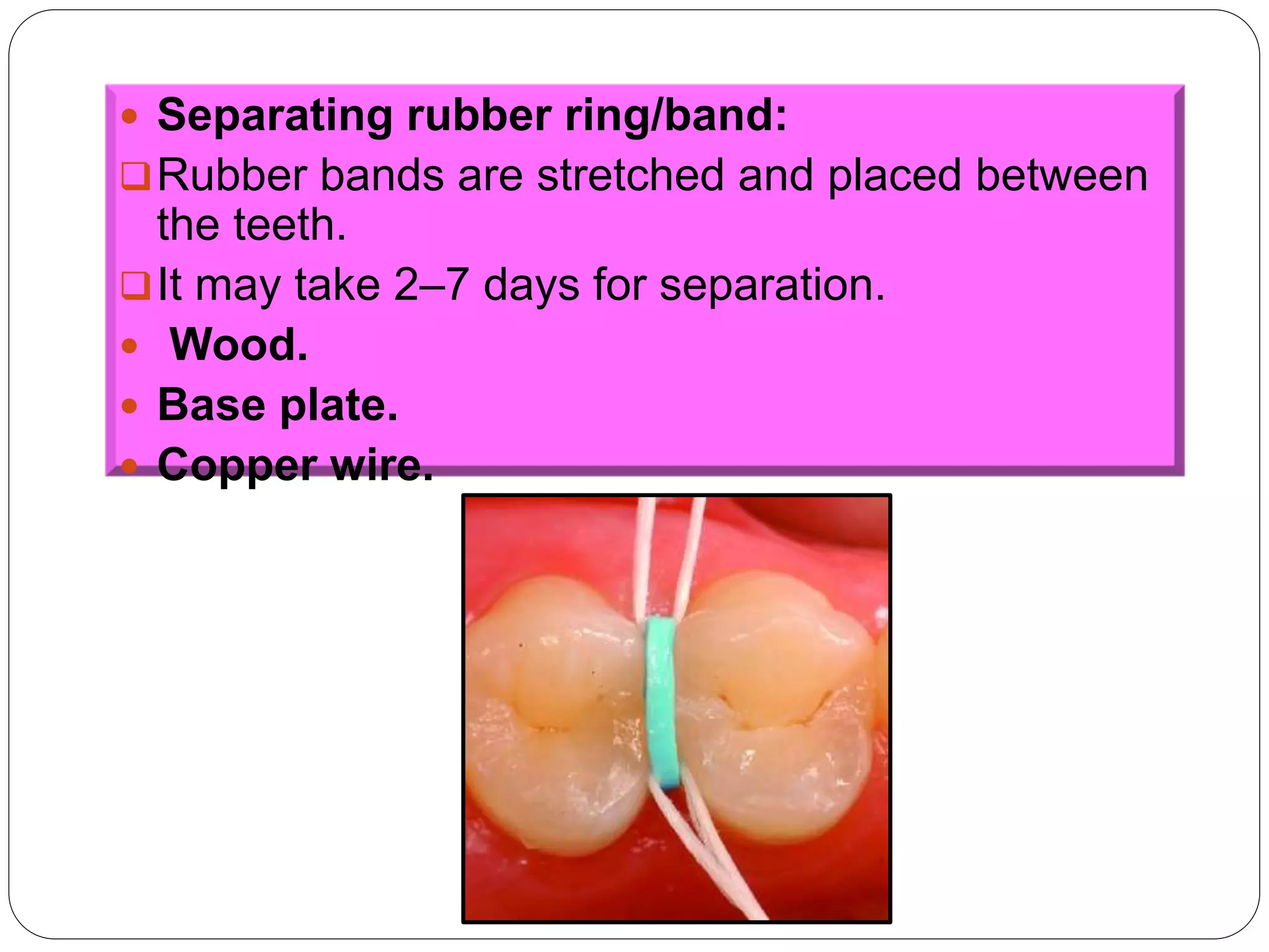 TOOTH SEPERATION.pptx