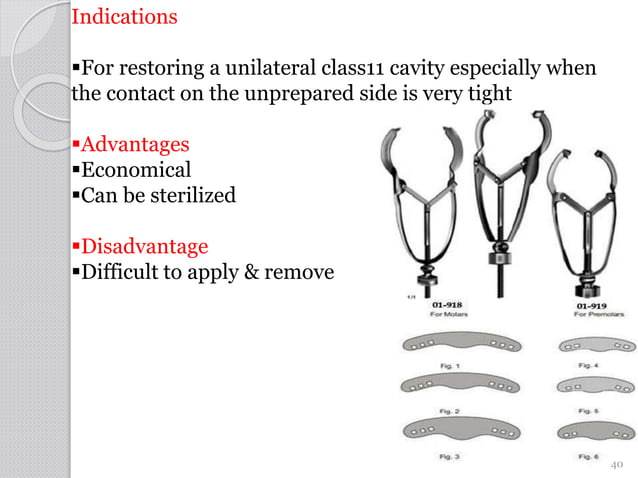 Tooth seperation matrix wedges amjath | PPTX | Dental Health | Diseases ...