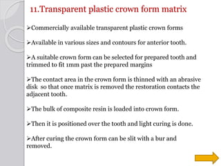 Tooth seperation matrix wedges amjath | PPTX