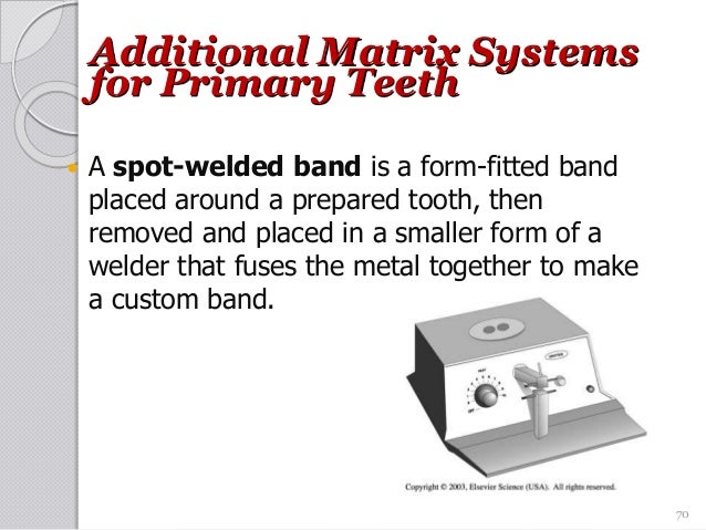 Tooth seperation matrix wedges amjath
