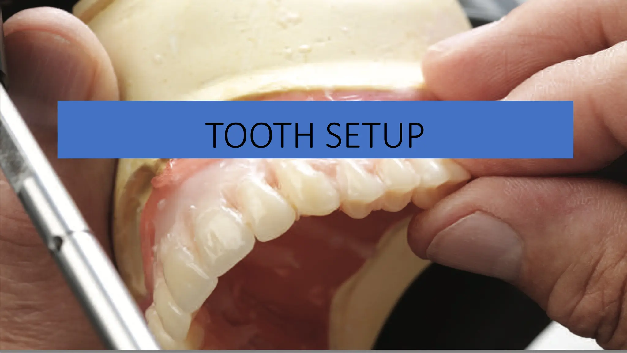 Arrangement of posterior teeth in edentulous patients.tooth set up .pptx