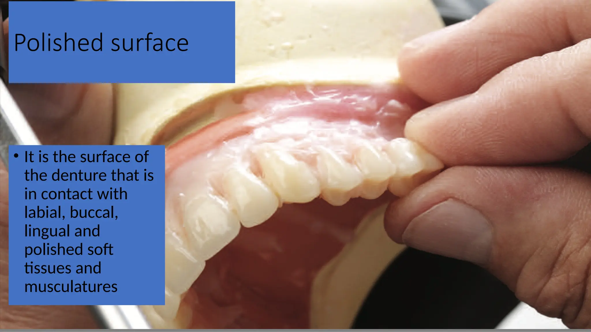 Arrangement of posterior teeth in edentulous patients.tooth set up .pptx