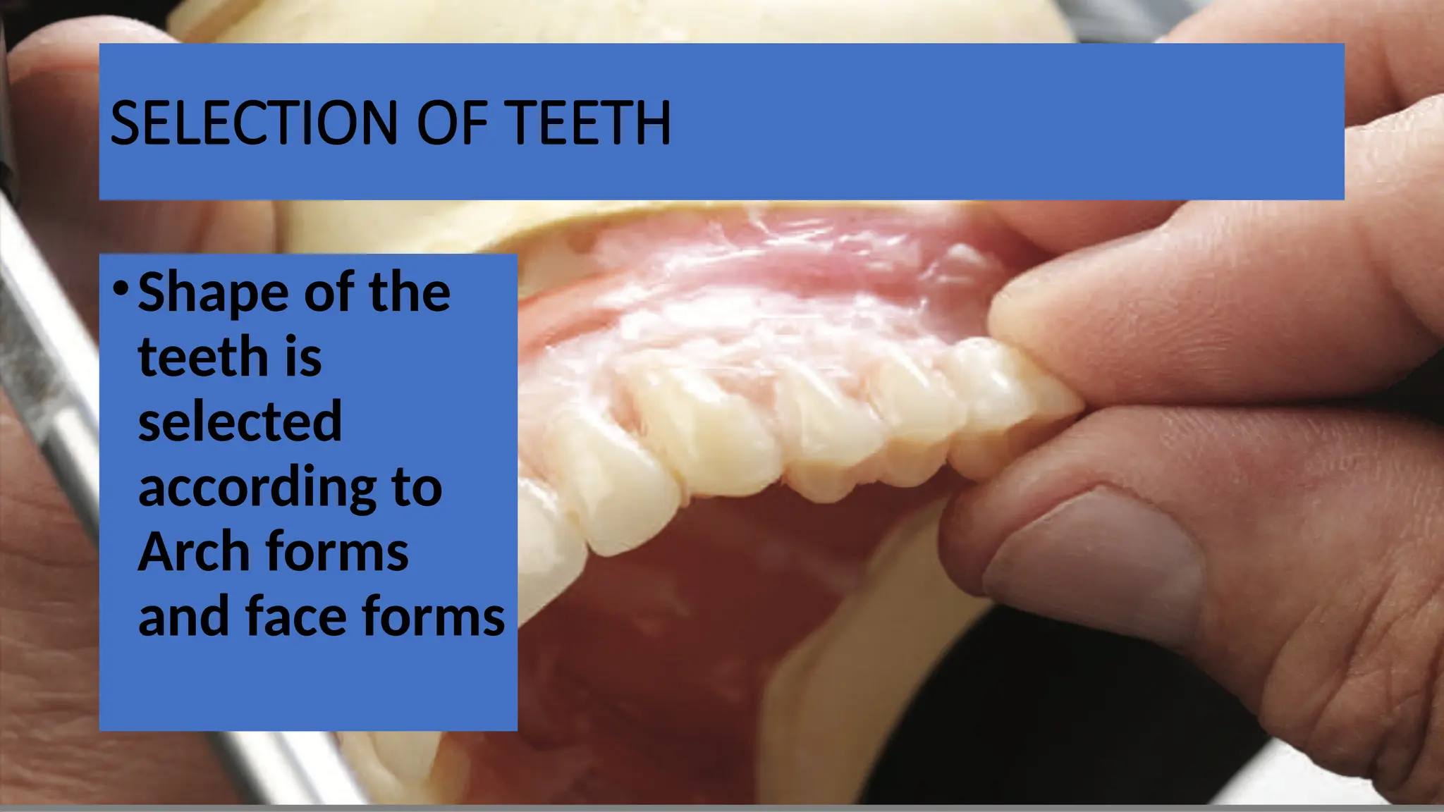 Arrangement of posterior teeth in edentulous patients.tooth set up .pptx