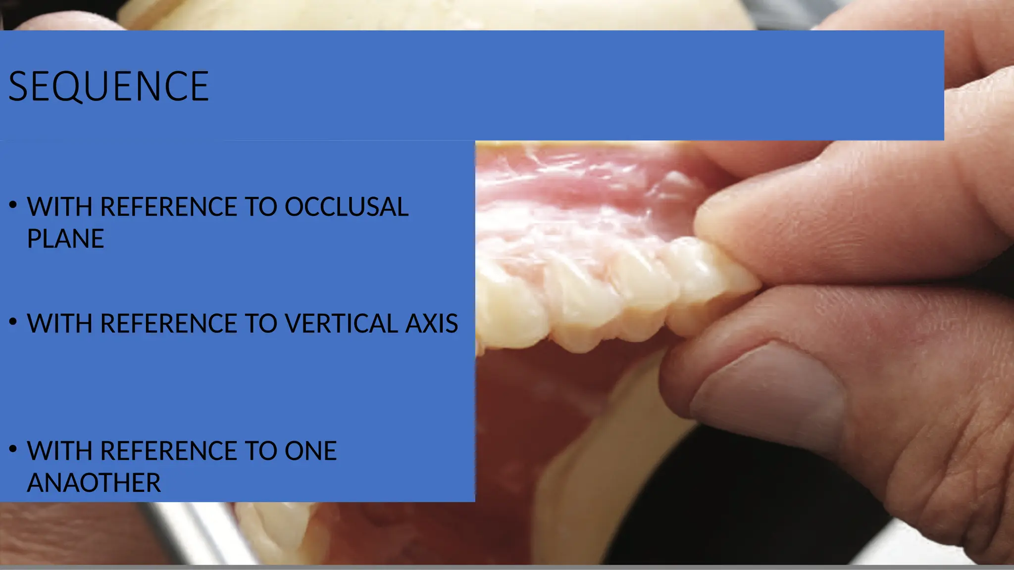 Arrangement of posterior teeth in edentulous patients.tooth set up .pptx