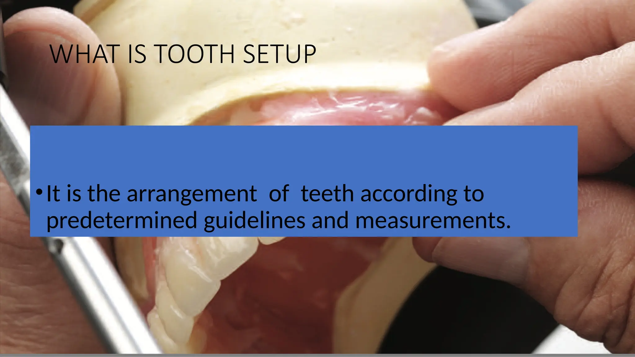 Arrangement of posterior teeth in edentulous patients.tooth set up .pptx