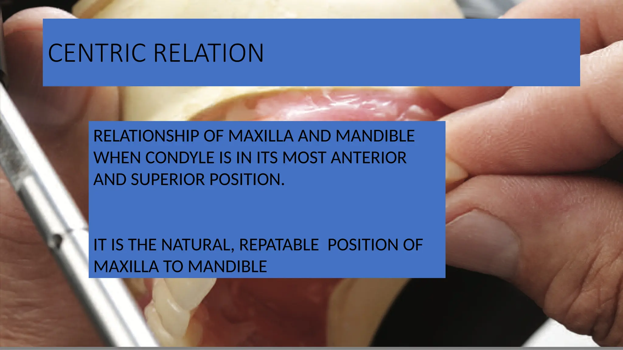 Arrangement of posterior teeth in edentulous patients.tooth set up .pptx