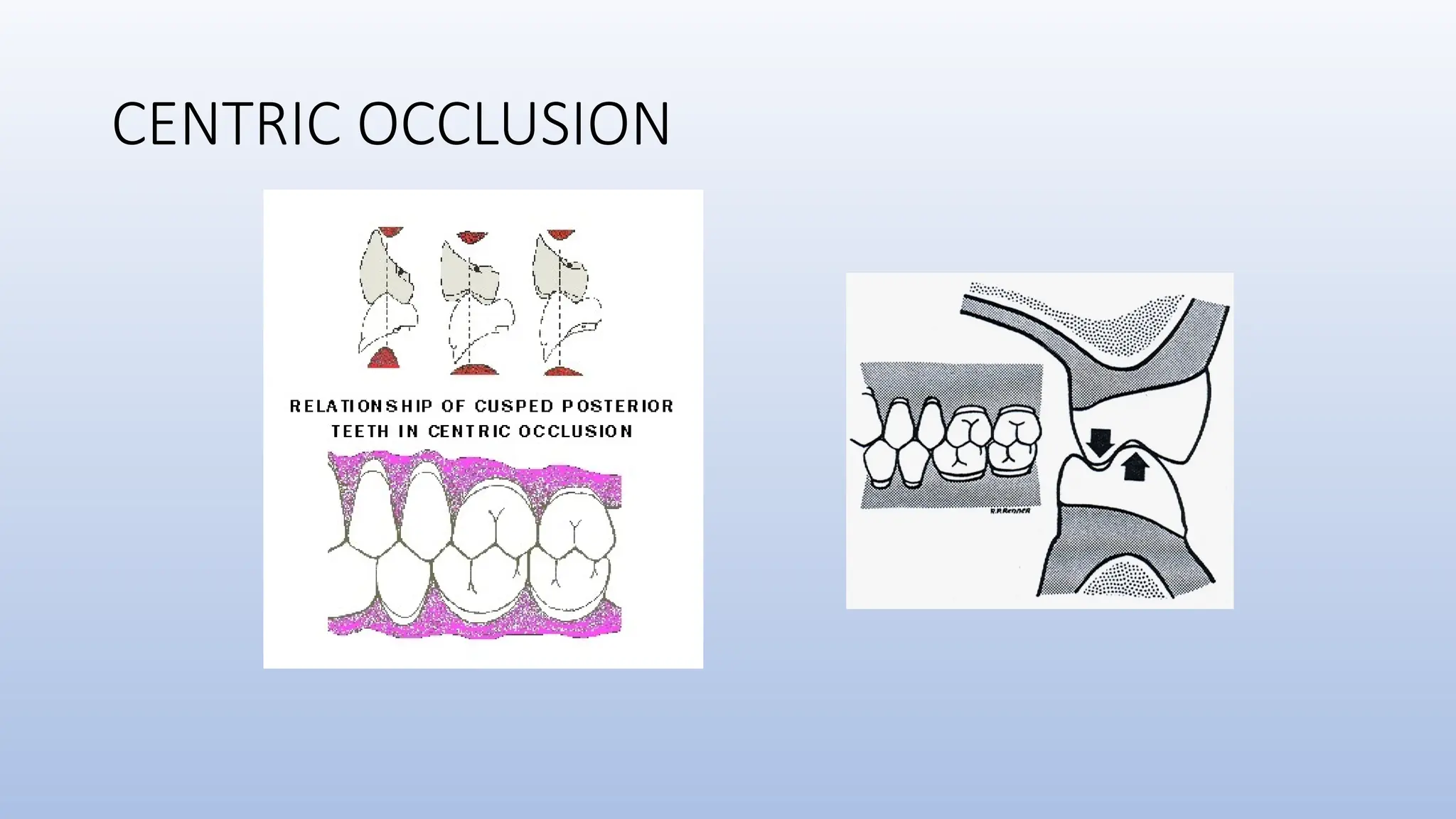 Arrangement of posterior teeth in edentulous patients.tooth set up .pptx