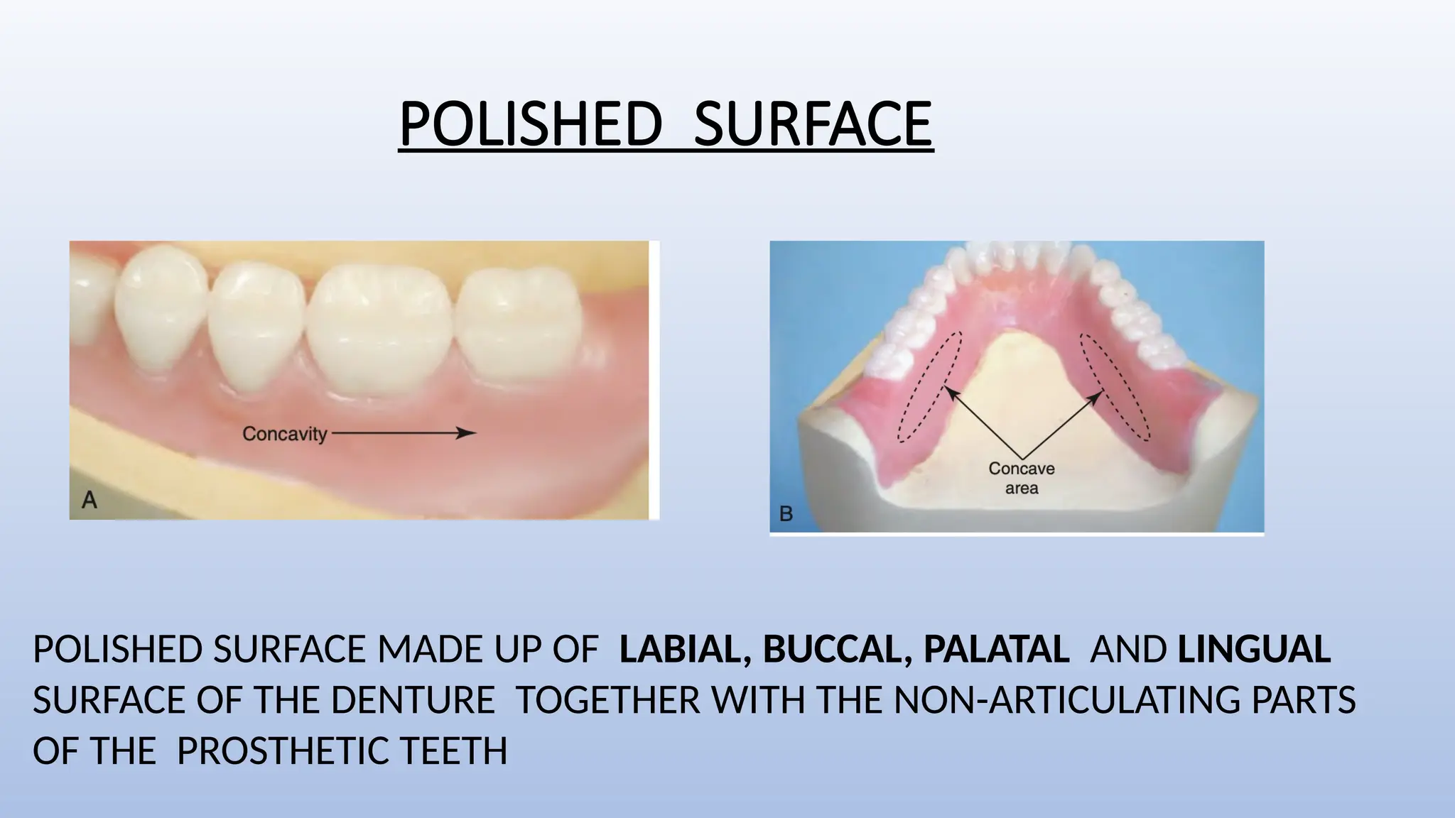 Arrangement of posterior teeth in edentulous patients.tooth set up .pptx