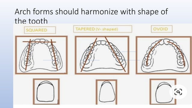 Arrangement of posterior teeth in edentulous patients.tooth set up .pptx