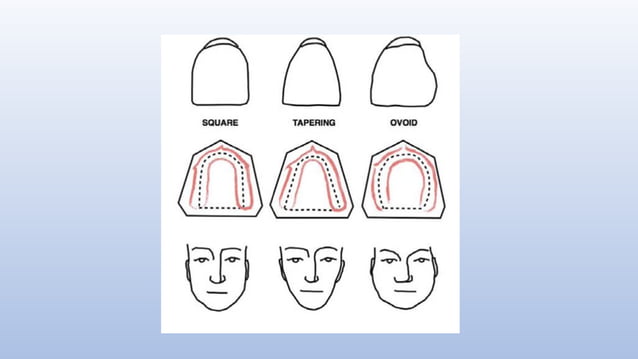 Arrangement of posterior teeth in edentulous patients.tooth set up .pptx