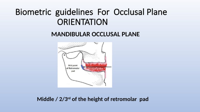 Arrangement of posterior teeth in edentulous patients.tooth set up .pptx