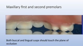 Arrangement of posterior teeth in edentulous patients.tooth set up .pptx
