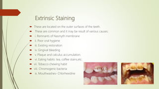 Tooth Staining and Discoloration | PPTX | Dental Health | Diseases and ...