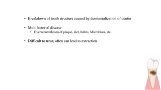 Tooth structure - Root expousure - Caries.pptx