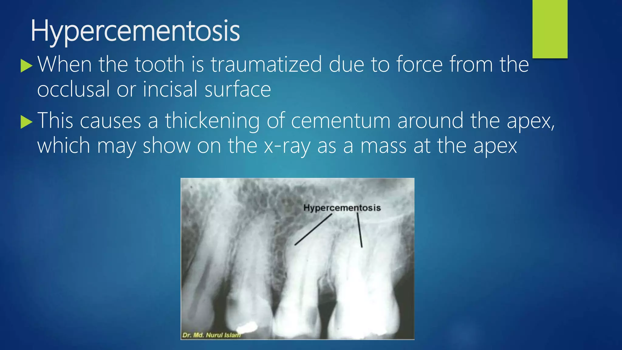 Tooth Structures, Periodontium, and Caries Classifications Powerpoint ...