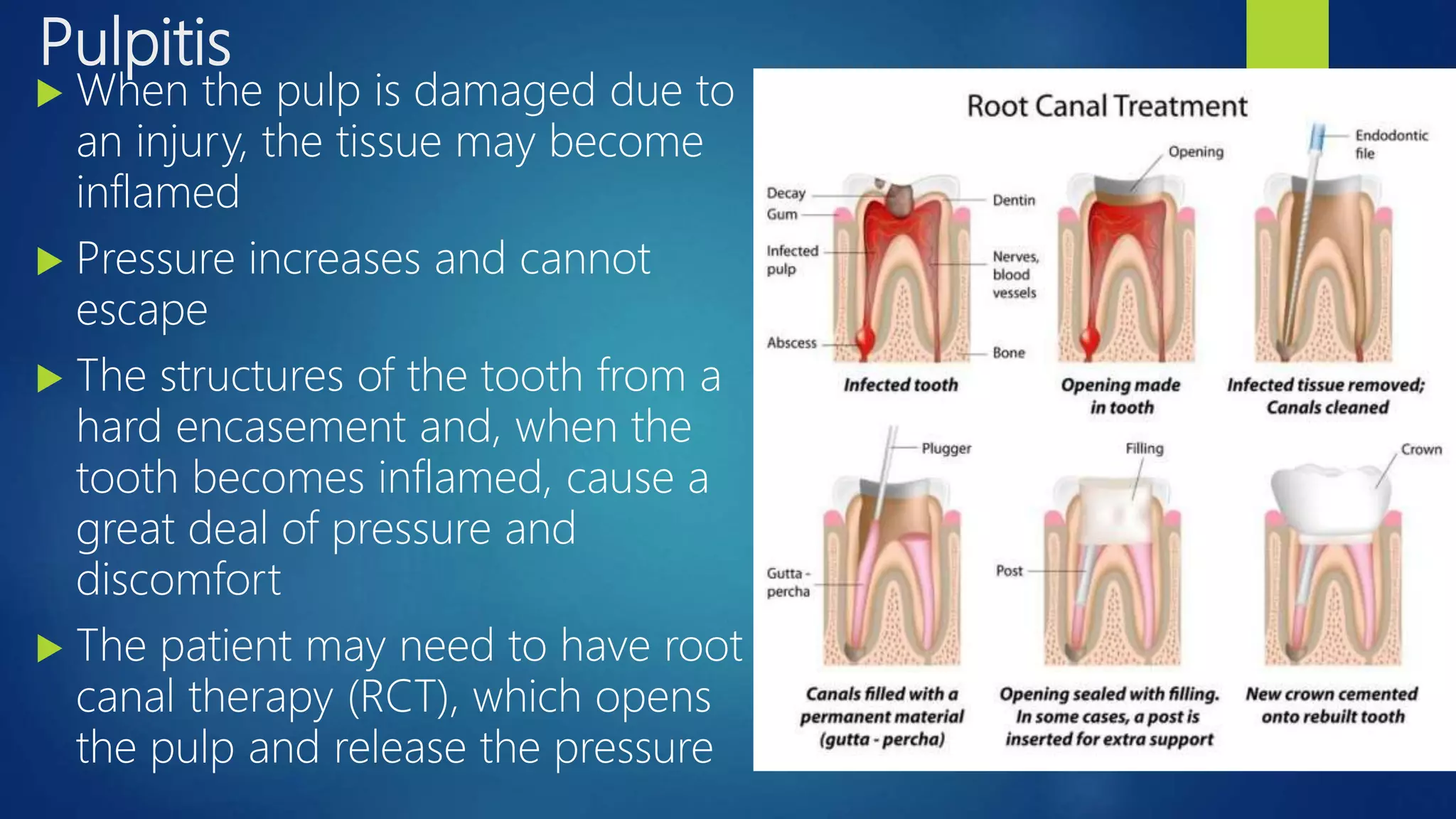 Tooth Structures, Periodontium, and Caries Classifications Powerpoint ...