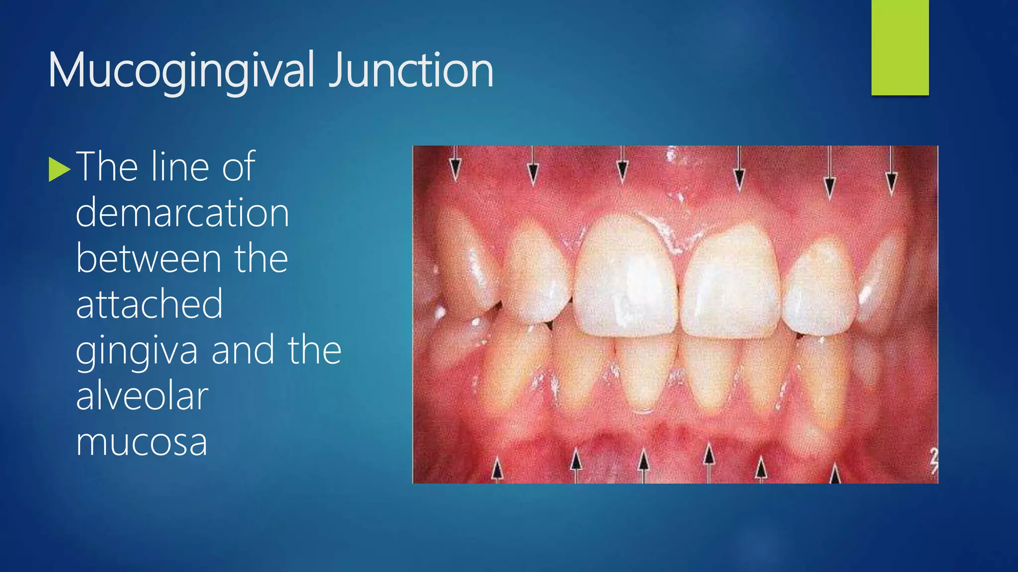 Tooth Structures, Periodontium, and Caries Classifications Powerpoint ...