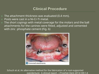 toothsupportedoverdentures in prosthodontics | PPT