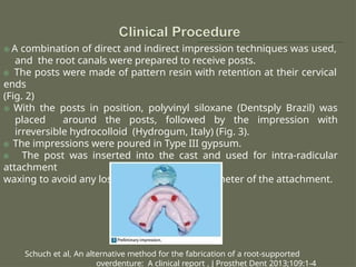 toothsupportedoverdentures in prosthodontics | PPT