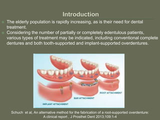 Tooth supported overdentures- Journal Club | PPT