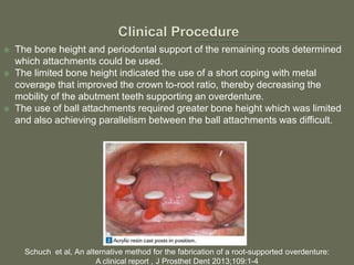 Tooth supported overdentures- Journal Club | PPT
