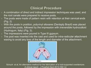 Tooth supported overdentures- Journal Club | PPT