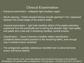 Altered Cast Impression Technique for Fabrication of Maxillary ...
