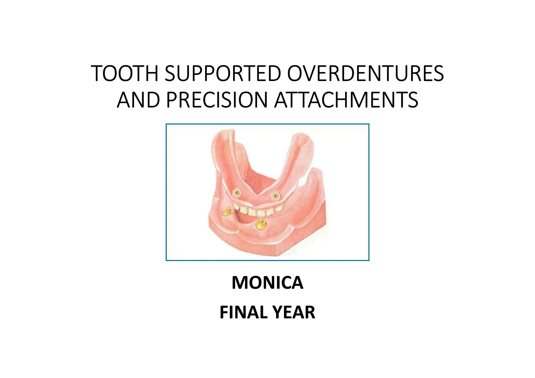 TOOTH SUPPORTED OVERDENTURES IN PROSTHODONTICS | PDF