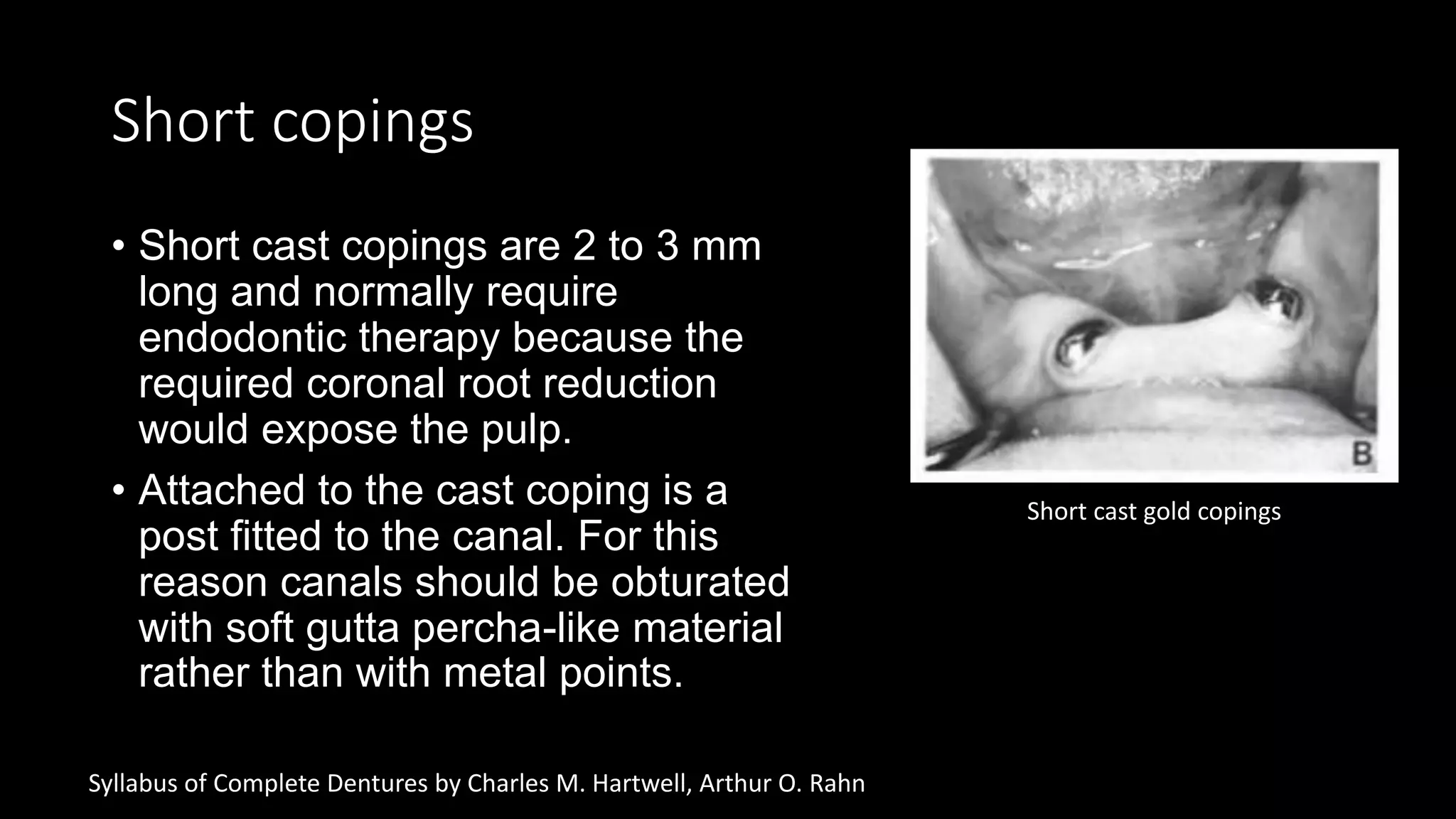 Tooth supported Overdentures | PPTX