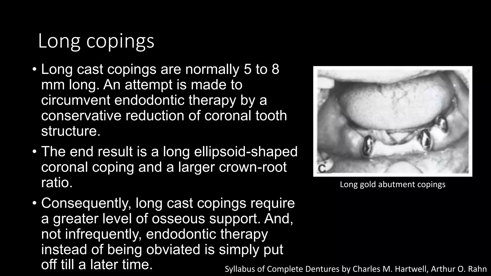 Tooth supported Overdentures | PPTX