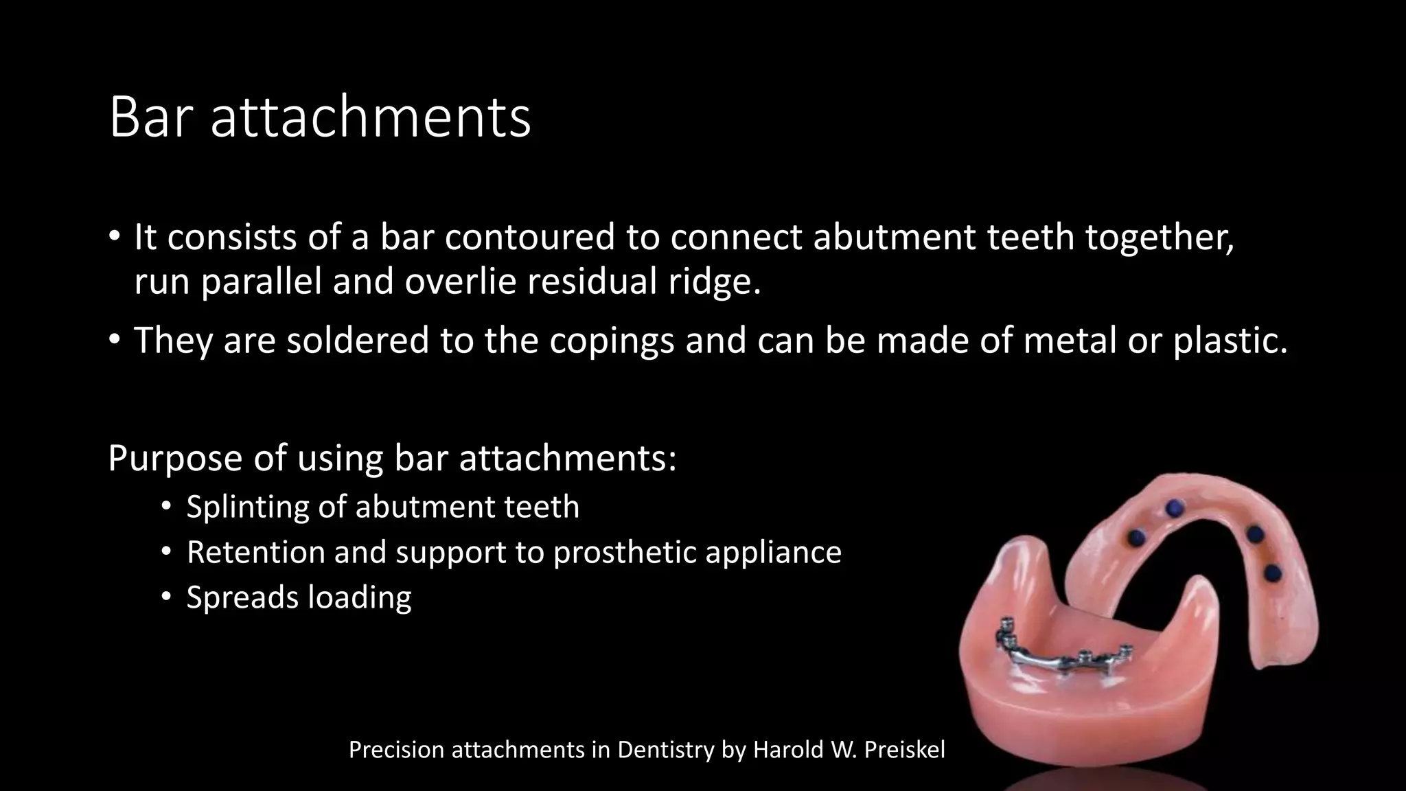 Tooth supported Overdentures | PPTX