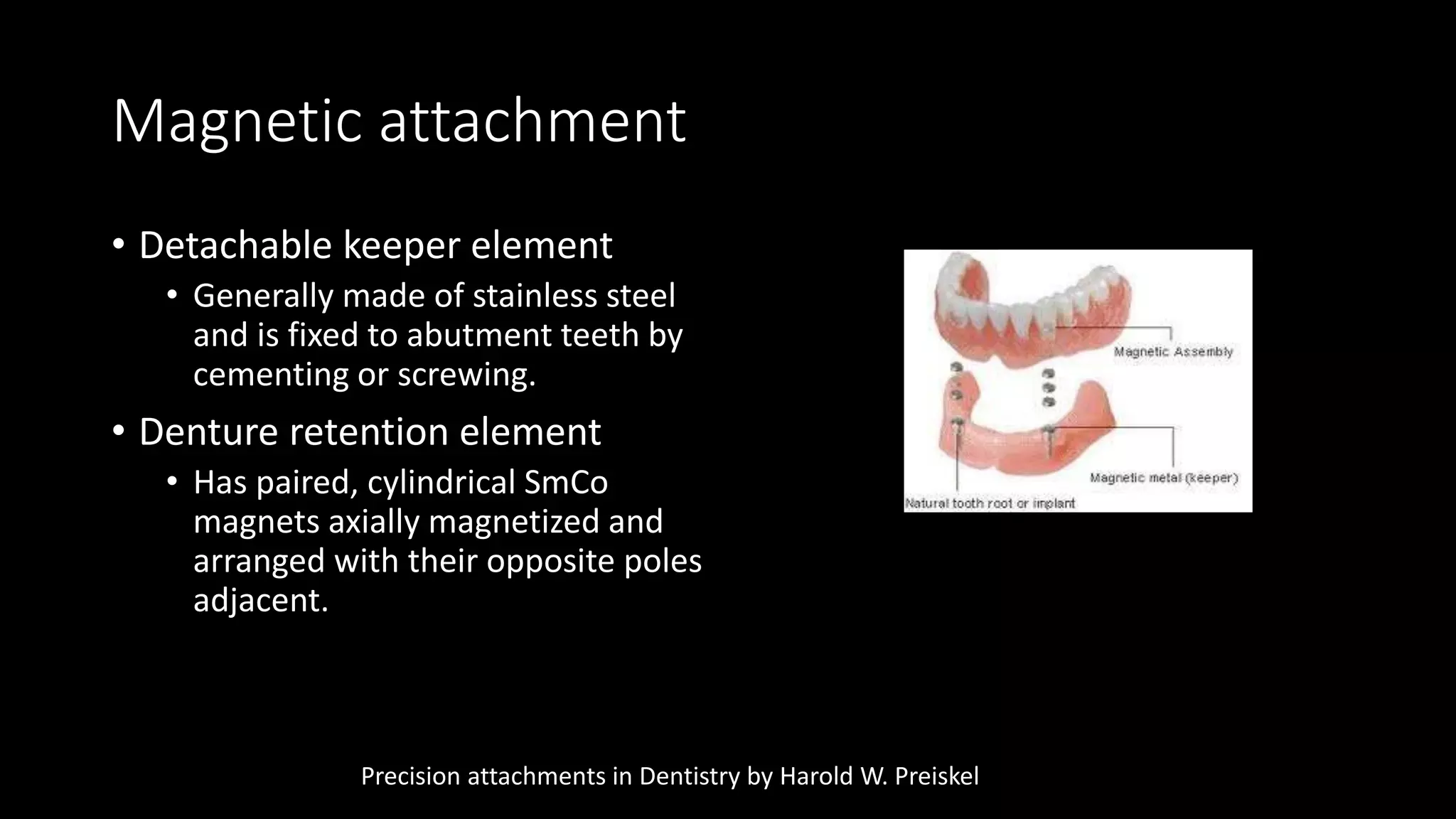 Tooth supported Overdentures | PPTX