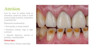 Tooth_Surface its a dental disease _Loss.pptx