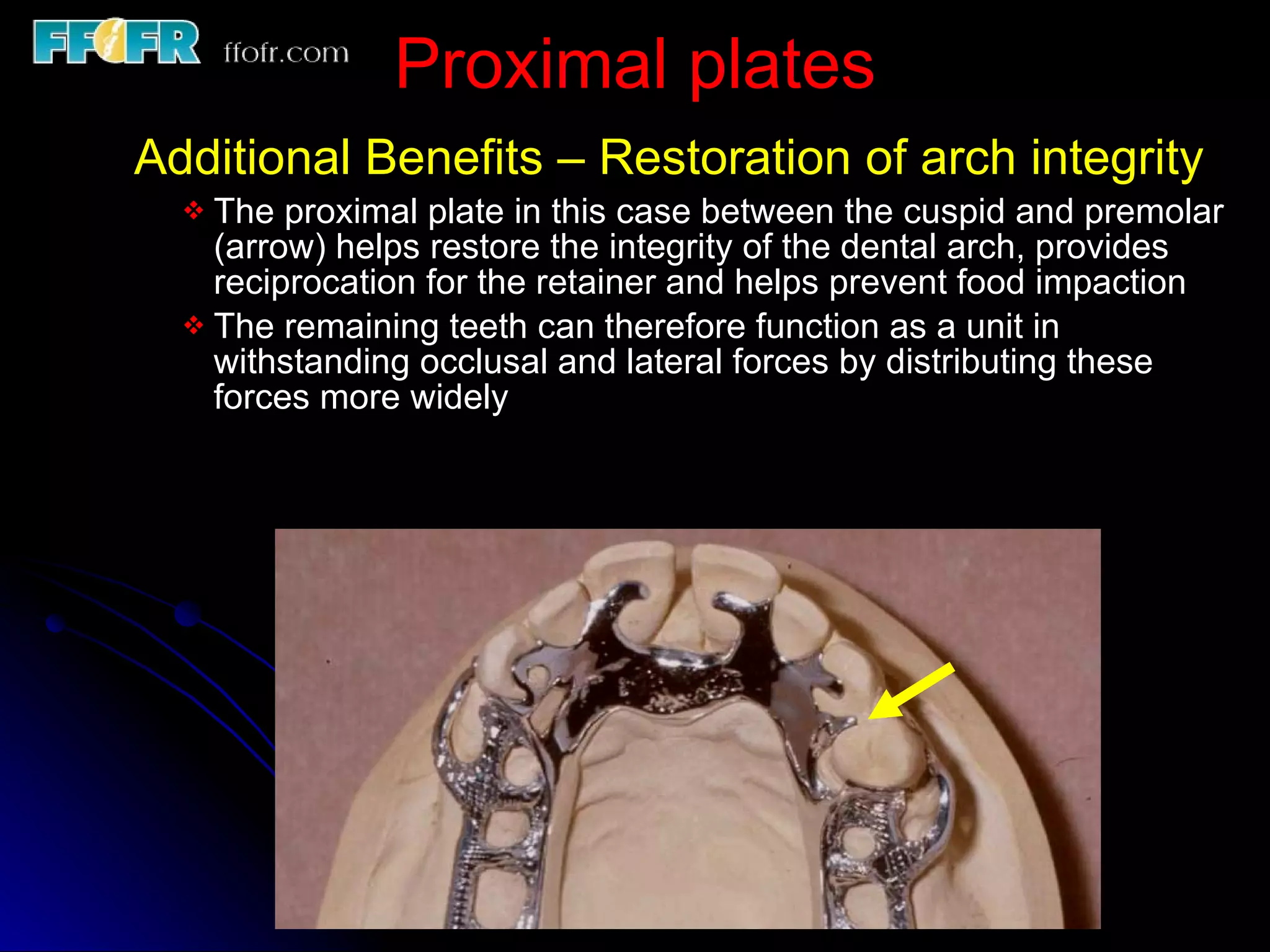 Tooth tissue junction, major and minor connectors | PPT